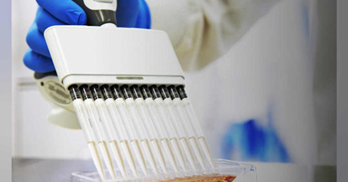 AbbVie to Buy Cancer Drugmaker Stemcentrx for $5.8 Billion | IndustryWeek AbbVie to Buy Cancer Drugmaker Stemcentrx for $5.8 Billion | IndustryWeek